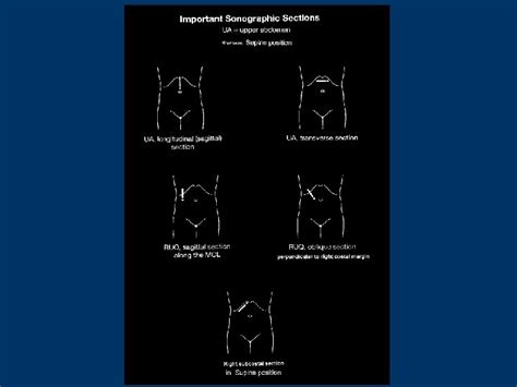 Us Hepatobiliary System Technique And Us In Hepatobiliary
