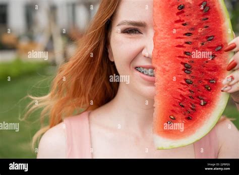 Beautiful Red Haired Woman Smiling With Braces On Her Teeth Covers Half