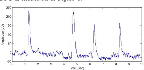 figure 2 from an adaptive method to remove ocular artifacts from eeg