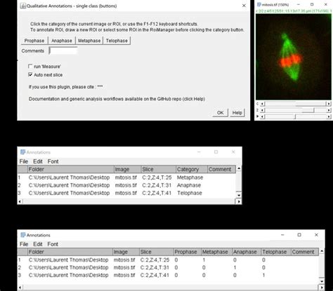 The Single Class Buttons Qualitative Annotation Plugin At The Top Is