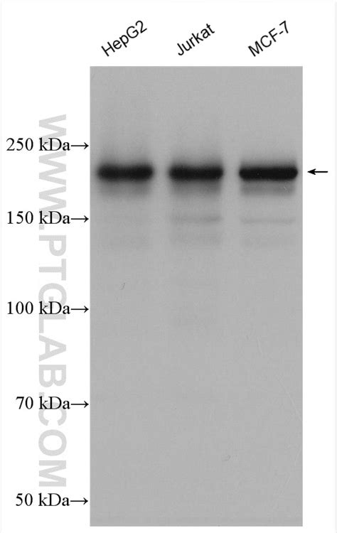 Phip Antibody 20933 1 Ap Proteintech