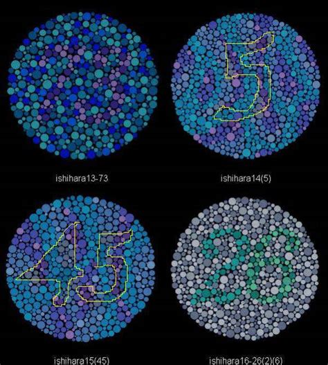 Protan Deutan And Tritan Color Blindness Warehouse Of Ideas