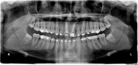 M3 Class Object Detection Dataset By New Workspace Q6gxr