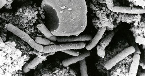 Anthrax 84 Cdc Workers Might Have Been Exposed To Pathogen Los