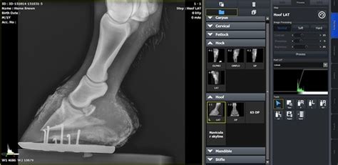 Vxvue Digital X Ray Company