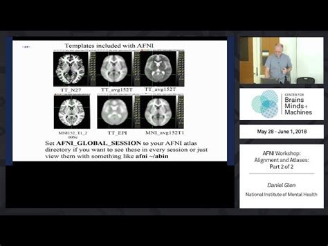 Free Video Alignment And Atlases Part 2 Of 2 From Mitcbmm Class Central