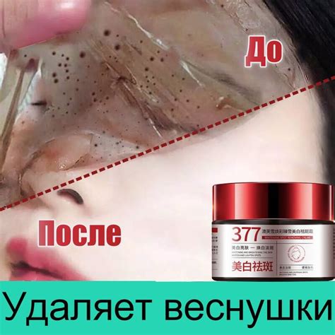 Крем для лица от Веснушек и Пигментных пятен 30г против пигментации отбеливающий для лица