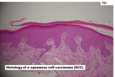 Introduction To Dermatoscopy