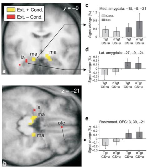 Functional Overlaps And Dissociations In Amygdala And Ofc During Download Scientific Diagram
