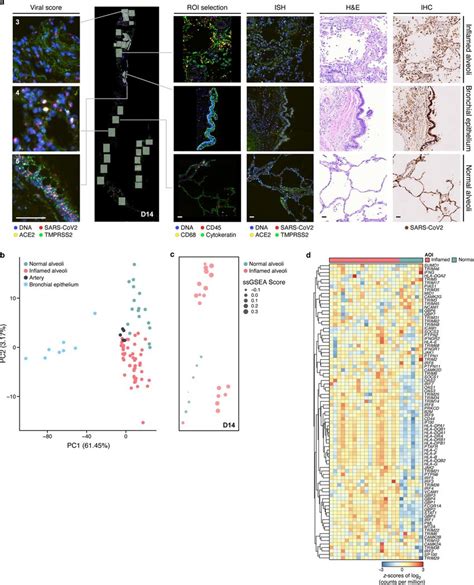 Geomx Wta Dsp Analysis Of Lung Biopsy Samples Reveals Region And Download Scientific Diagram