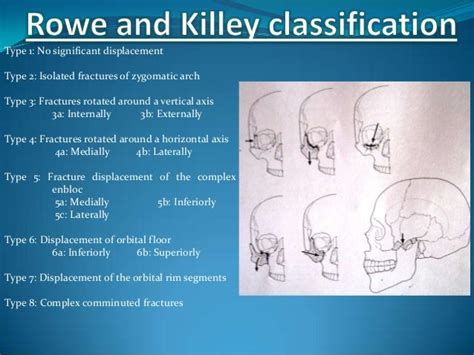 Classification Of Zmc Fractures Pdf