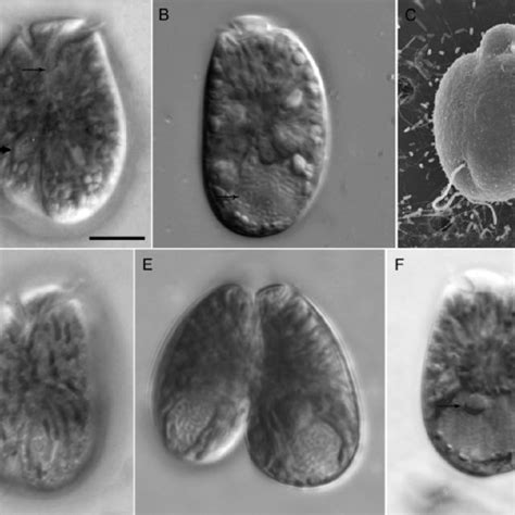 Pdf Amphidinium Revisited Ii Resolving Species Boundaries In The Amphidinium Operculatum