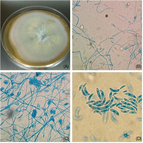 A Six Days Of Fusarium Solani Culture Sabouraud Dextrose Agar Sda