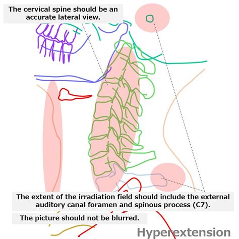 Cervical Spine Hyperflexion And Hyperextension View｜tools For Radtech