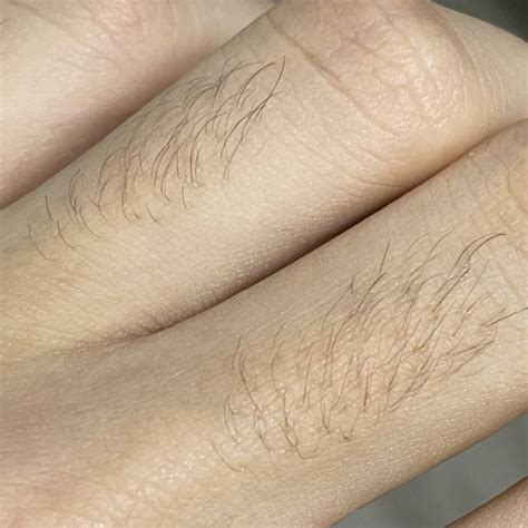 이런 손가락 털 가정용 레이저 제모기 사서 쓰면 효과 있을까 인스티즈 Instiz 익명잡담 카테고리