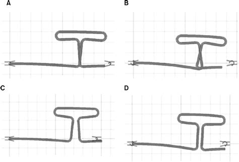 Schematic Representation Of The T Loop Generated By The Loop Computer Schematic Representation Of The T Loop Generated By The Loop Computer