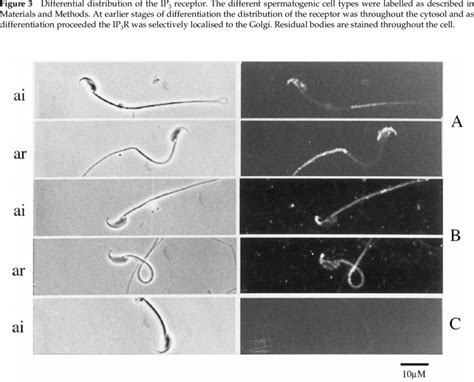 Immunofluorescence Staining Of Mouse Sperm Acrosome Intact Ai Or Download Scientific Diagram