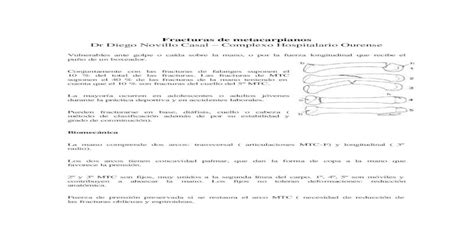 Fractura De Metacarpianos [pdf Document]