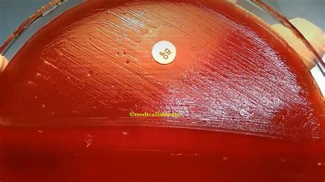 Pneumococcus And Viridans Streptococci Introduction Differentiat