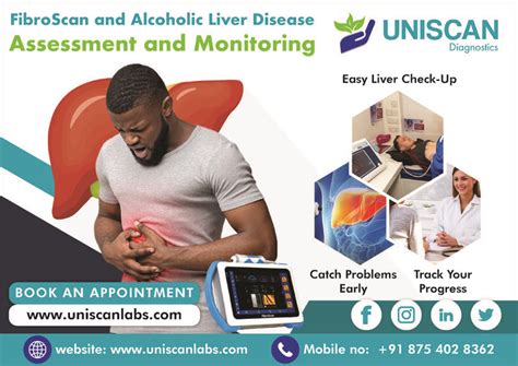 Fibroscan And Alcoholic Liver Disease Assessment And Monitoring