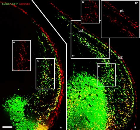 calbindin labeled migratory gabaergic interneurons in the e13 5 mouse