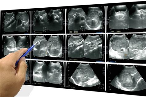 Здравствена Станица Карабурма Дом здравља “Др Милутин Ивковић” Палилула