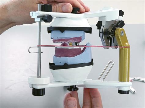 Removable Prosthetics Conventional Dental Workflows Ivoclar