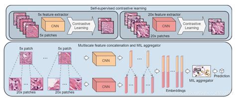 Dual Stream Multiple Instance Learning Networks For Tumor Detection In