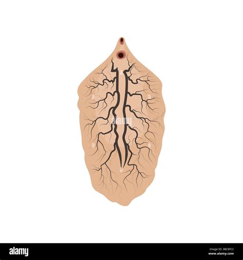 Liver Fluke A Parasitic Flatworm Showing Branched Digestive System And Oral Sucker Causing
