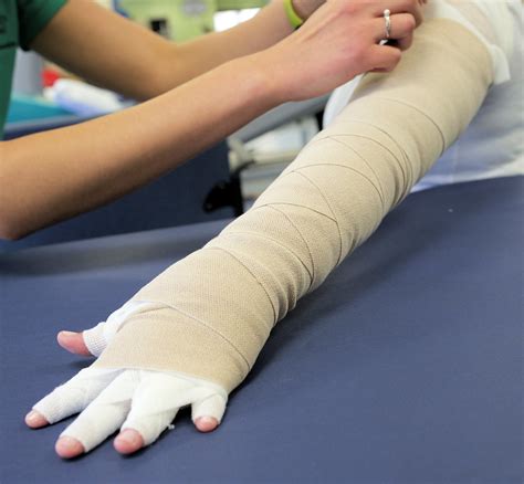 Lymphedema Is Swelling Of Ankles Physio Village Clinic