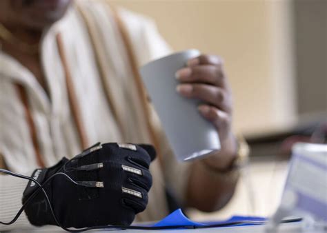 Neuromodulation Stroke Research Clinicaltrials Upperextremity Cleveland Fes Center