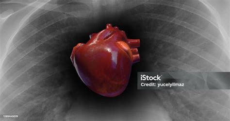 건강한 인간의 심장이 뛰고 있습니다 배경에 엑스레이 해골 3d 일러스트 렌더 0명에 대한 스톡 사진 및 기타 이미지 0명 3d 스캔 3차원 형태 Istock