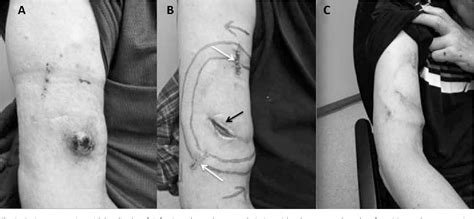 Figure 2 From Operative And Perioperative Management Of Infected