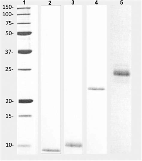 Assessment Of The Purity Of Recombinant Mycobacterial Proteins The