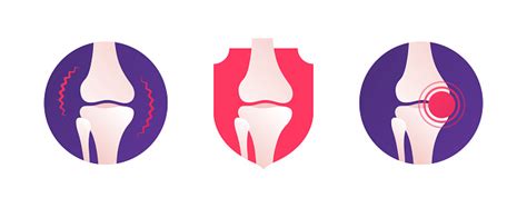 인간의 장기 수집 벡터 플랫 현대 해부학 아이콘 색상 일러스트레이션 흰색 배경에 고립 된 통증 기호와 무릎 관절 뼈 건강 관리 의료 표지판 정형 외과에 대한 설계 요소