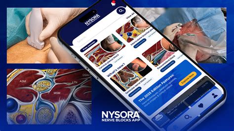 Just Added Intercostobrachial Nerve Block Technique Now Available In The Nysora Nerve Blocks
