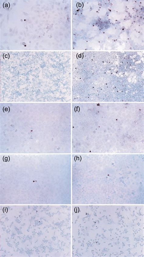 A J Apoptotic Cell Detection By Tunel Assay Was Performed A Kk47 Download Scientific Diagram