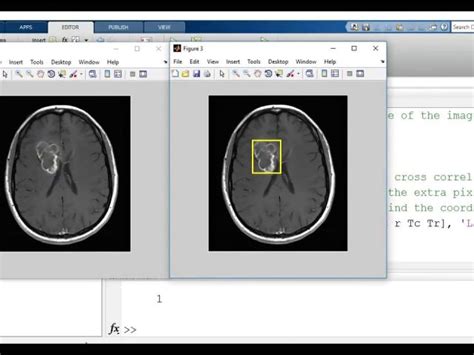 Template Matching In Image Processing Template Matching Image Processing And Computer Vision
