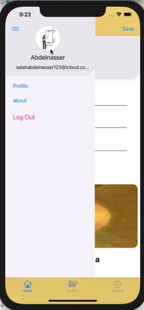 Github Abdelnasser Glaucoma Detection