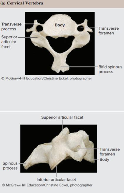 Transverse Process Cervical Vertebrae
