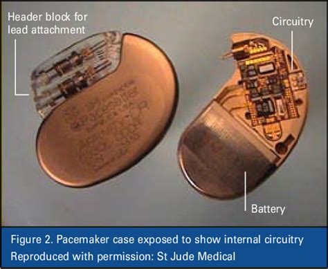 Figure 2 From Pacemaker Therapies In Cardiology Semantic Scholar
