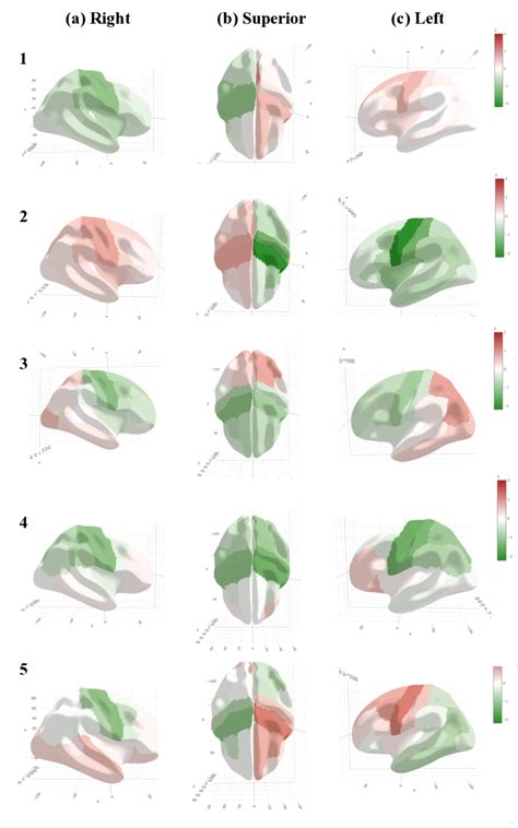 Five Estimated Latent Connectivity Dimensions From A The Lateral View