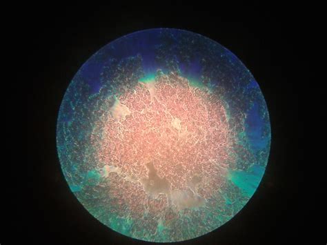 Mis Eritrocitos Tomada Del Microscopio Durante La Practica Flickr