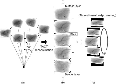 Figure 2 From Qualitative Near Infrared Vascular Imaging System With