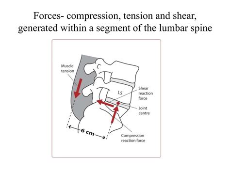 Intervertebral Disc And Prolapse Of Intervertrebral Discpptx