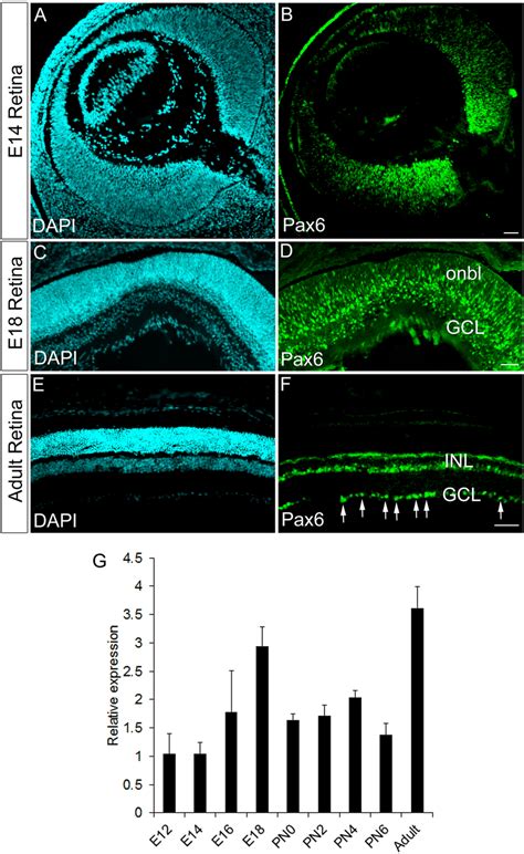 Persistent Expression Of Pax6 In Differentiated Rgcs Af