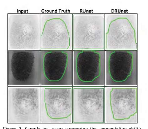 Figure 1 From Explainable Fingerprint Roi Segmentation Using Monte Carlo Dropout Semantic Scholar