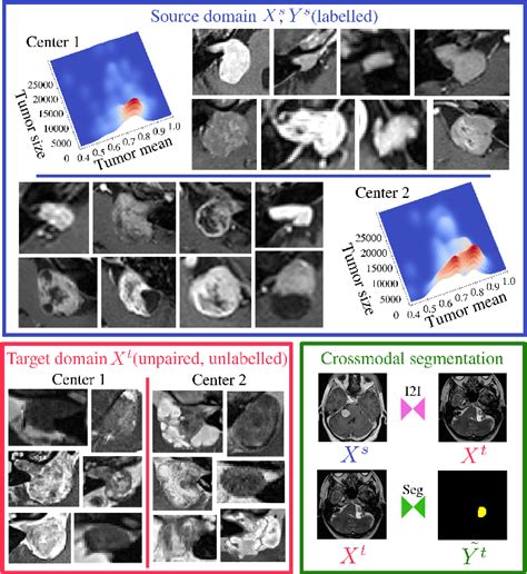 Figure 1 From Cross Modal Tumor Segmentation Using Generative Blending Augmentation And Self