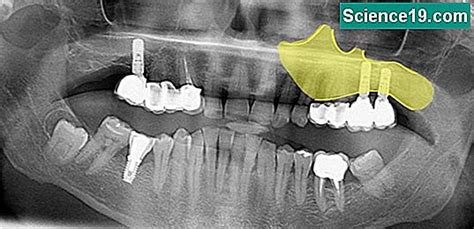 Zašto Postoje Puferi U Fermentaciji 💫 Znanstveno Popularni