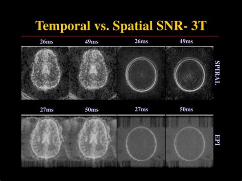 Ppt Spatial Temporal And Interpretive Limits Of Functional Mri Powerpoint Presentation Id